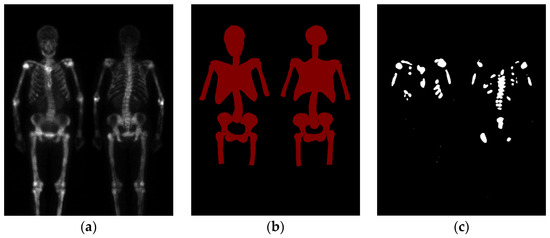 Skeleton Segmentation on Bone Scintigraphy for BSI Computation