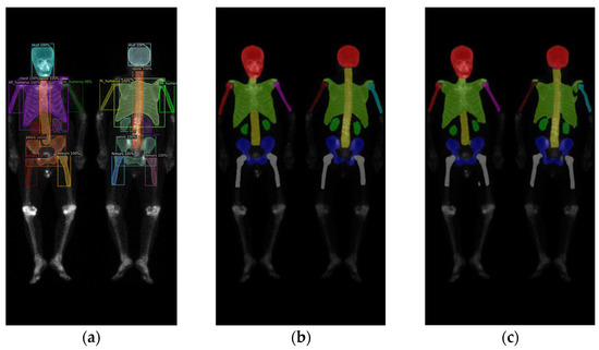Skeleton Segmentation on Bone Scintigraphy for BSI Computation