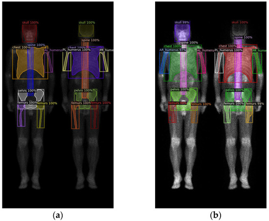 Skeleton Segmentation on Bone Scintigraphy for BSI Computation