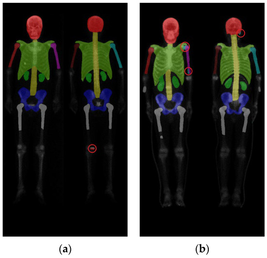 Skeleton Segmentation on Bone Scintigraphy for BSI Computation