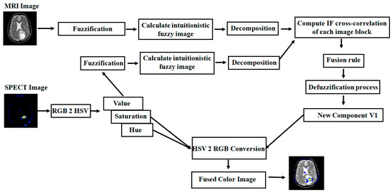 Diagnostics | Free Full-Text | An Improved Multimodal Medical Image Fusion Approach Using ...