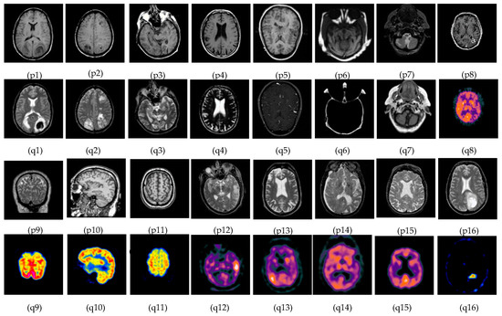 Diagnostics | Free Full-Text | An Improved Multimodal Medical Image ...