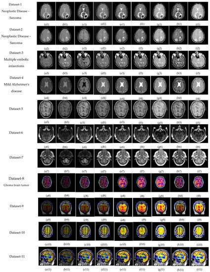 An Improved Multimodal Medical Image Fusion Approach Using ...