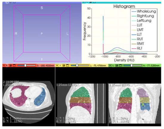 Diagnostics | Free Full-Text | Beyond Visual Interpretation ...