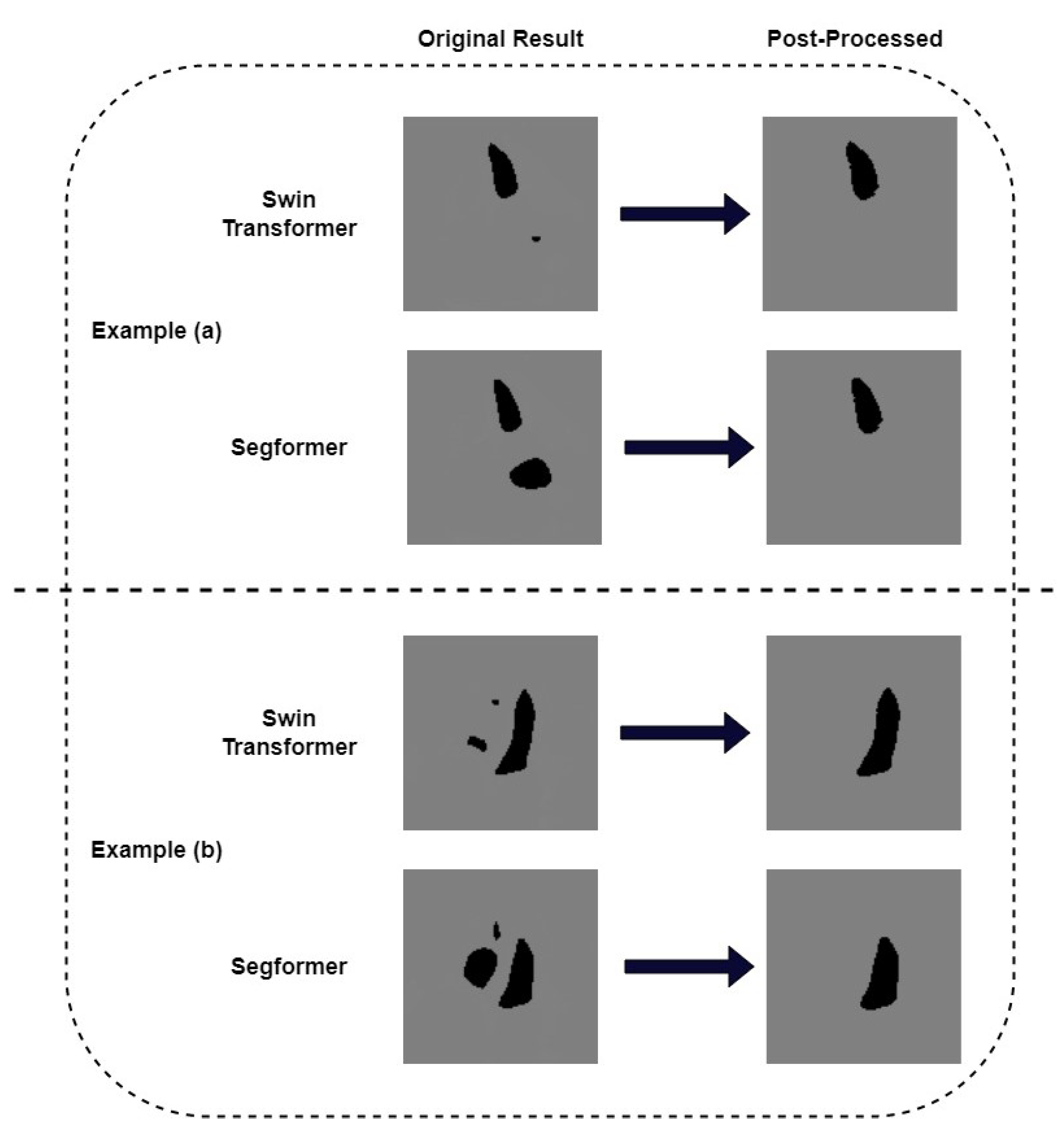 Left Ventricle Segmentation in Echocardiography with Transformer