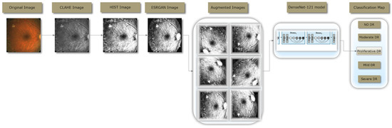 Enhancement of Diabetic Retinopathy Prognostication Using Deep Learning ...