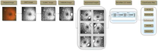 Enhancement of Diabetic Retinopathy Prognostication Using Deep Learning ...