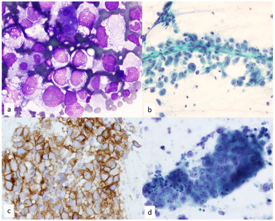 Diagnostics | Free Full-Text | The Utility of Fine Needle Aspiration ...