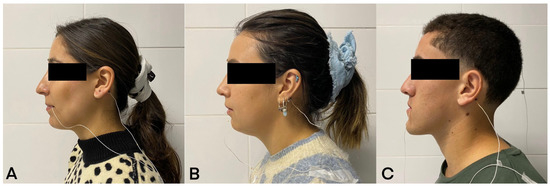 Characterization of Mandibular Border Movements and Mastication in Each ...