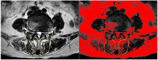 Physical Functional Ability and Quantitative Assessment of the ...