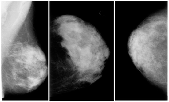 A Review of Machine Learning Techniques for the Classification and ...