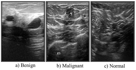 A Review of Machine Learning Techniques for the Classification and ...
