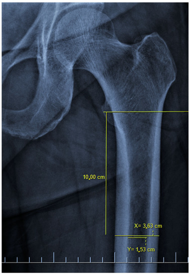 Diagnostics | Free Full-Text | Evaluation of the Relationship between ...