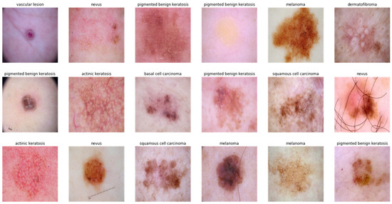 Diagnostics | Free Full-Text | Assist-Dermo: A Lightweight Separable ...