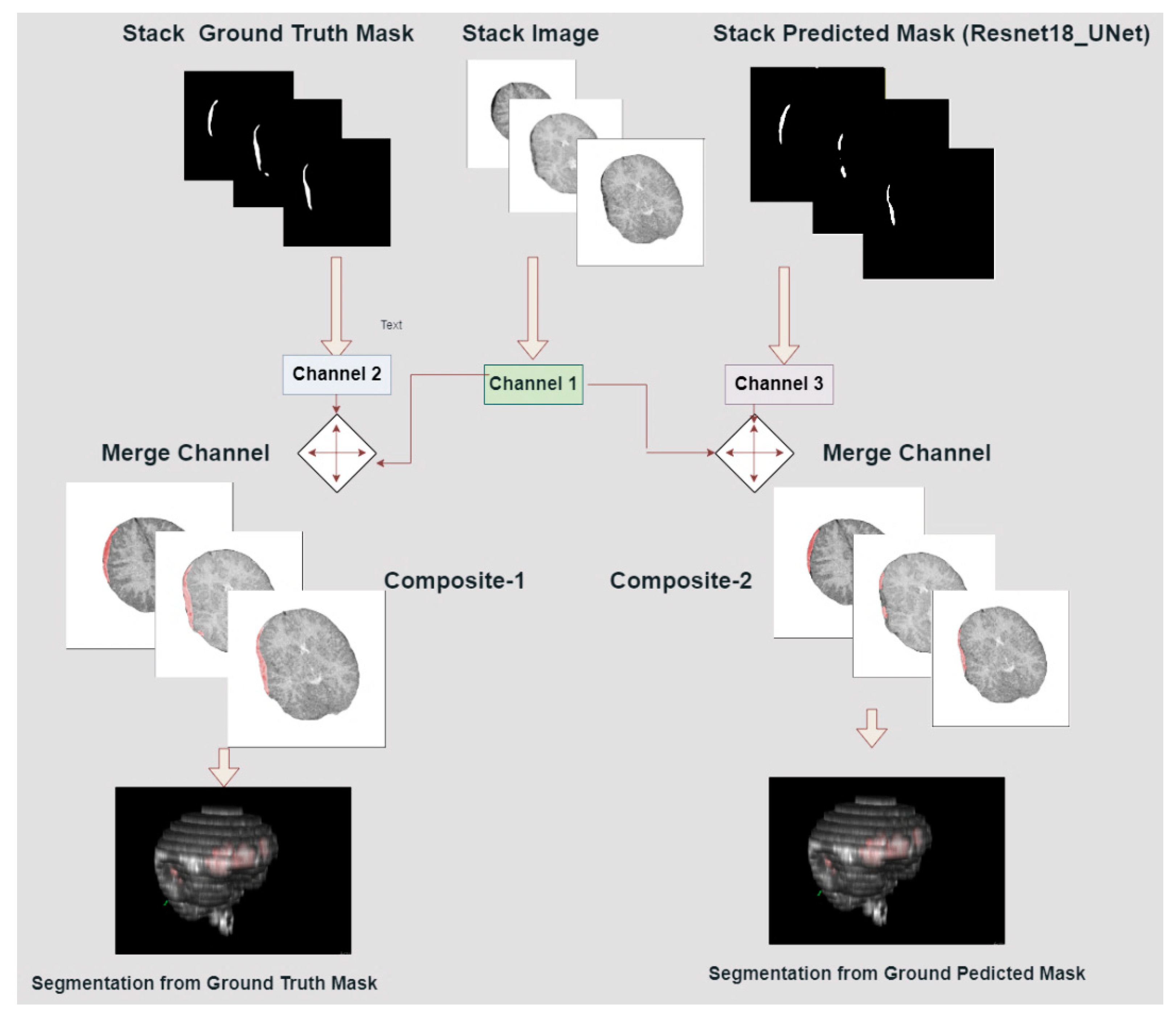 Diagnostics | Free Full-Text | A Deep Learning-Based Automatic Segmentation and 3D Visualization ...