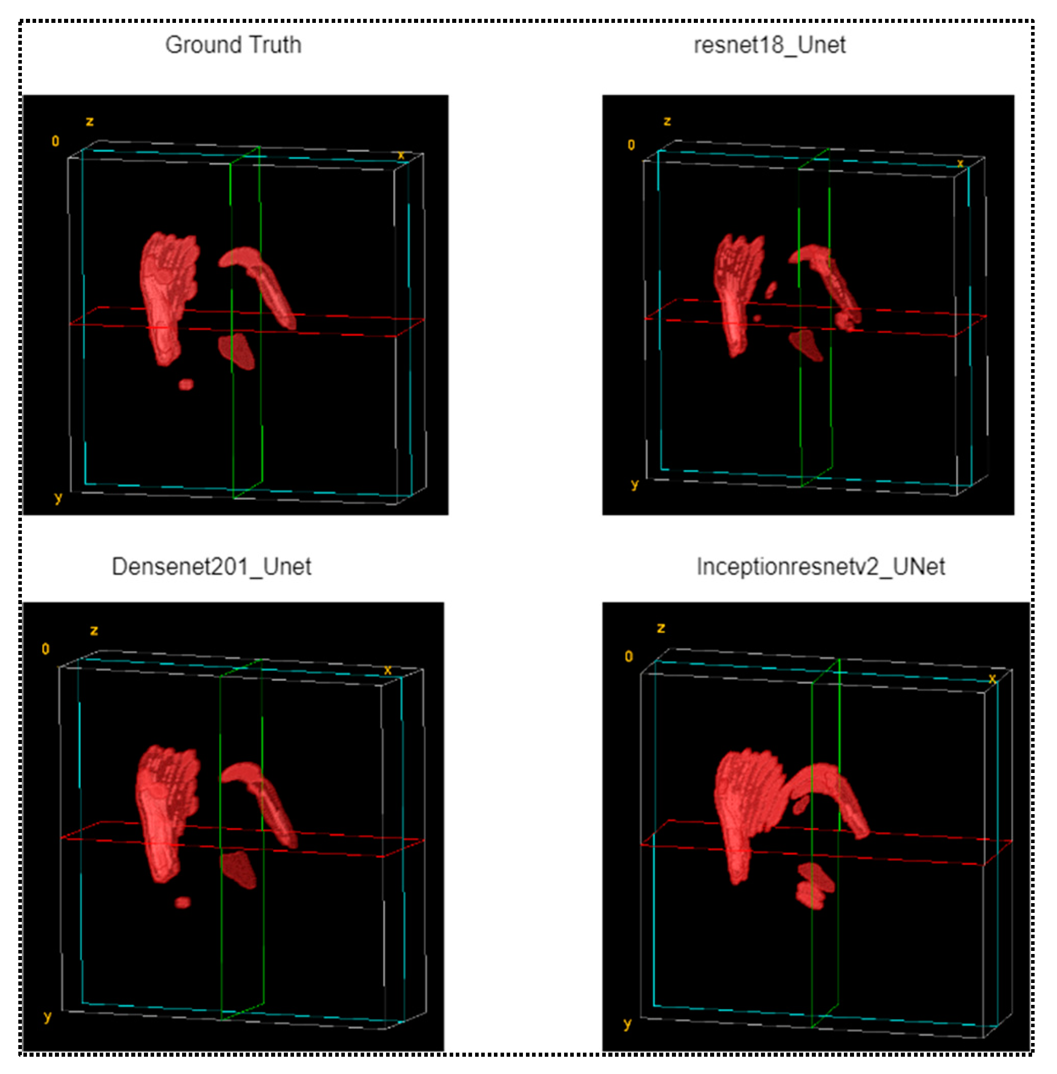 Diagnostics | Free Full-Text | A Deep Learning-Based Automatic Segmentation and 3D Visualization ...