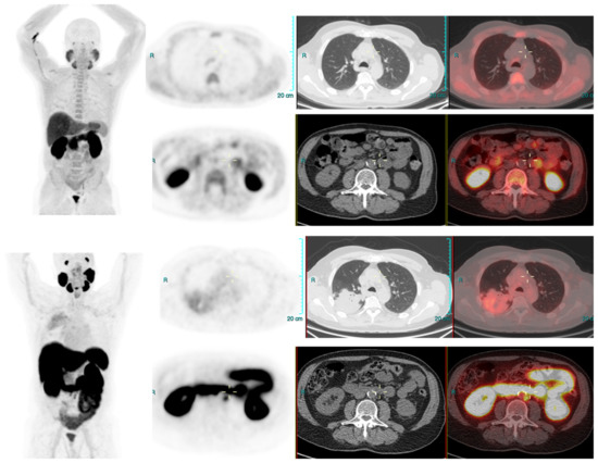 Diagnostics | Free Full-Text | Lessons from a 3-Year Review of PSMA PET ...