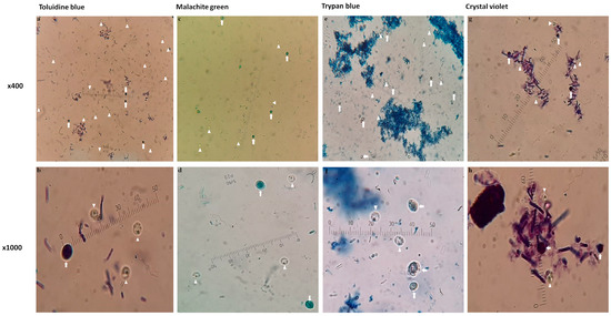 Diagnostic Performance of Toluidine Blue Stain for Direct Wet Mount ...