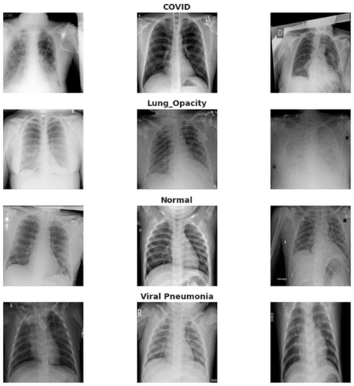 Diagnostics | Free Full-Text | Optimized Xception Learning Model and XgBoost Classifier for ...
