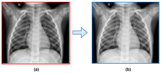 Optimized Xception Learning Model and XgBoost Classifier for Detection ...