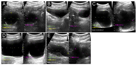 Diagnostics | Free Full-Text | Comparative Effectiveness of Two Models ...