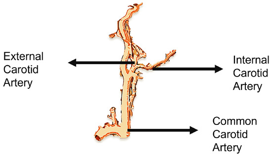 Diagnostics | Free Full-Text | Ultrasound-Based Image Analysis for ...