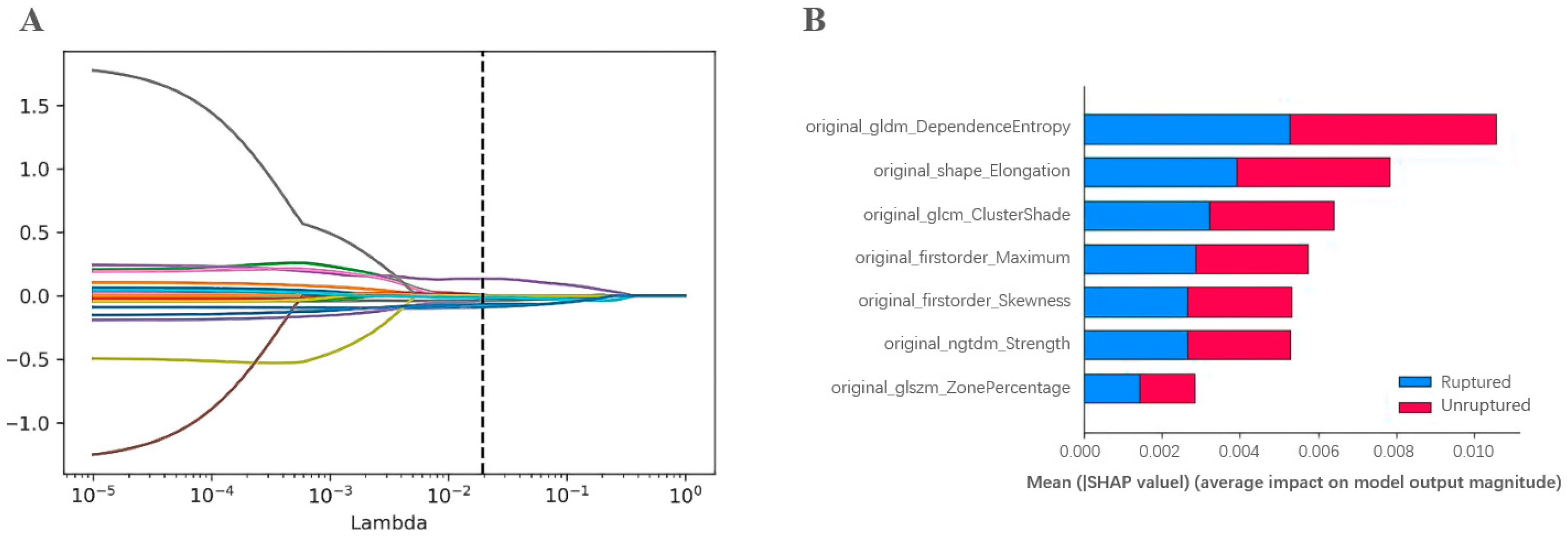 Comparison of Ruptured Intracranial Aneurysms Identification Using Different Machine Learning ...