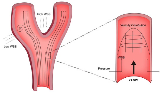 Mechanism Analysis of Vascular Calcification Based on Fluid Dynamics