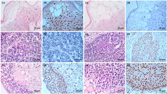 Differential Protein Expression Patterns of HOXA13 and HOXB13 Are ...