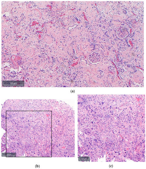 Minimally Invasive Tissue Sampling via Post Mortem Ultrasound: A ...
