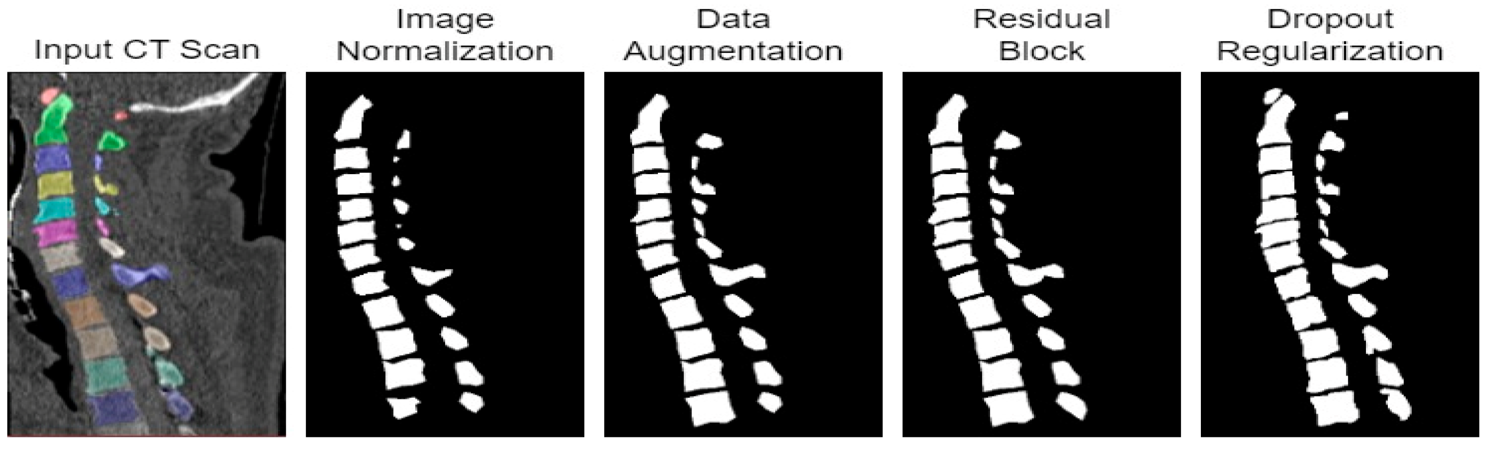 An Automated Deep Learning Approach for Spine Segmentation and Vertebrae Recognition Using ...