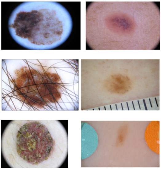 Skin Lesion Segmentation Using an Ensemble of Different Image ...