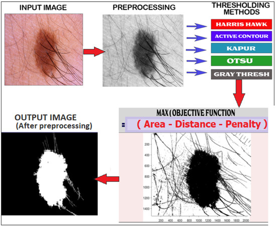 Skin Lesion Segmentation Using an Ensemble of Different Image Processing Methods