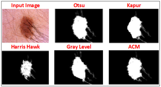 Skin Lesion Segmentation Using an Ensemble of Different Image ...