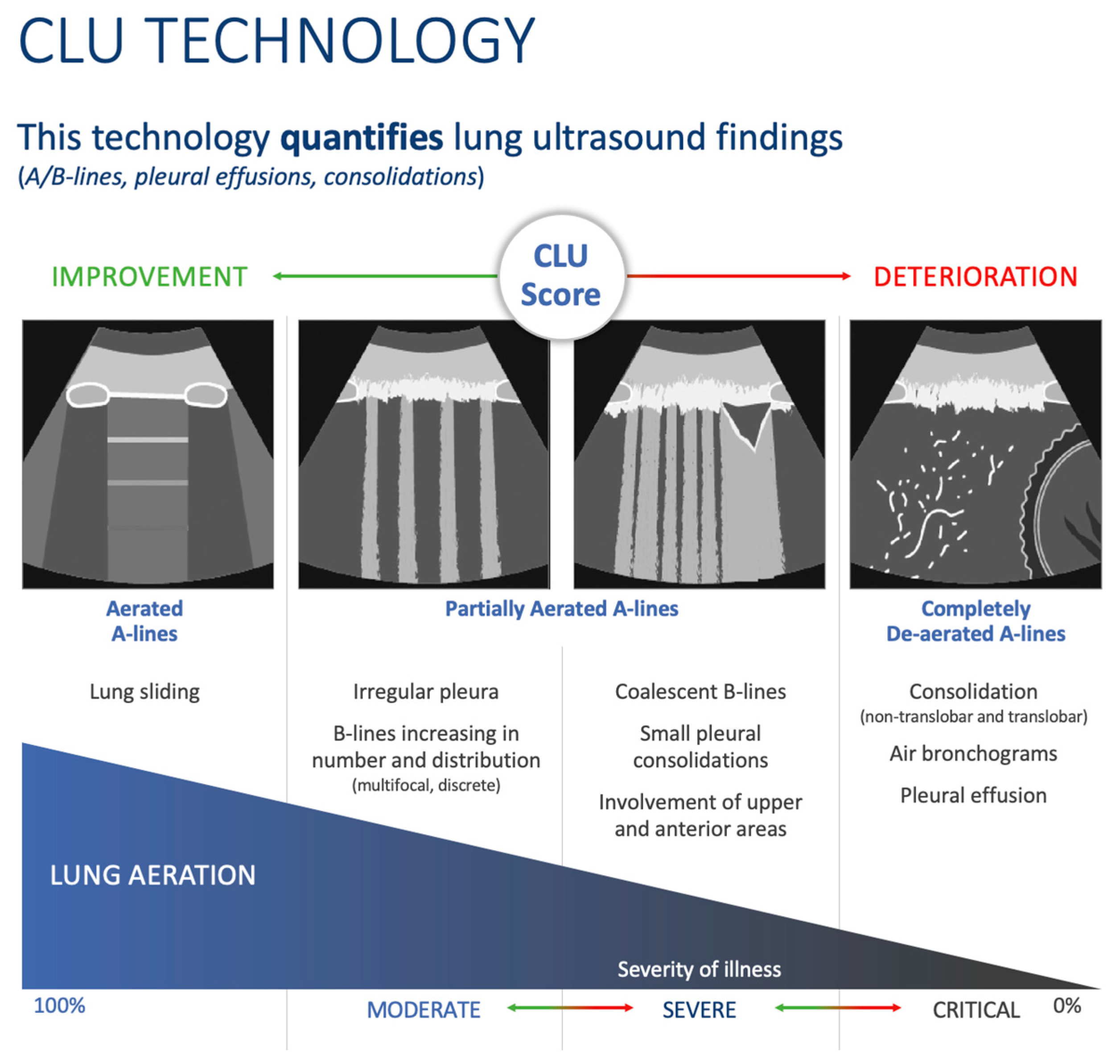 Automated Lung Ultrasound Pulmonary Disease Quantification Using an Unsupervised Machine ...