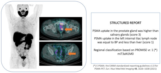 Prostate MRI and PSMA-PET in the Primary Diagnosis of Prostate Cancer