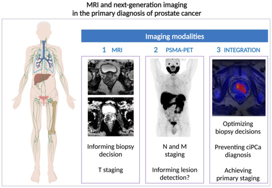 Prostate MRI and PSMA-PET in the Primary Diagnosis of Prostate Cancer