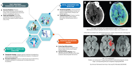 Redefining Radiology: A Review of Artificial Intelligence Integration ...