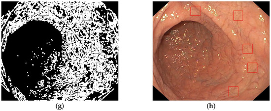 Computer-Based Diagnosis of Celiac Disease by Quantitative Processing ...