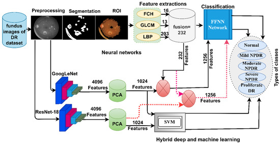 Diagnostics | Free Full-Text | Hybrid Methods for Fundus Image Analysis for Diagnosis of ...