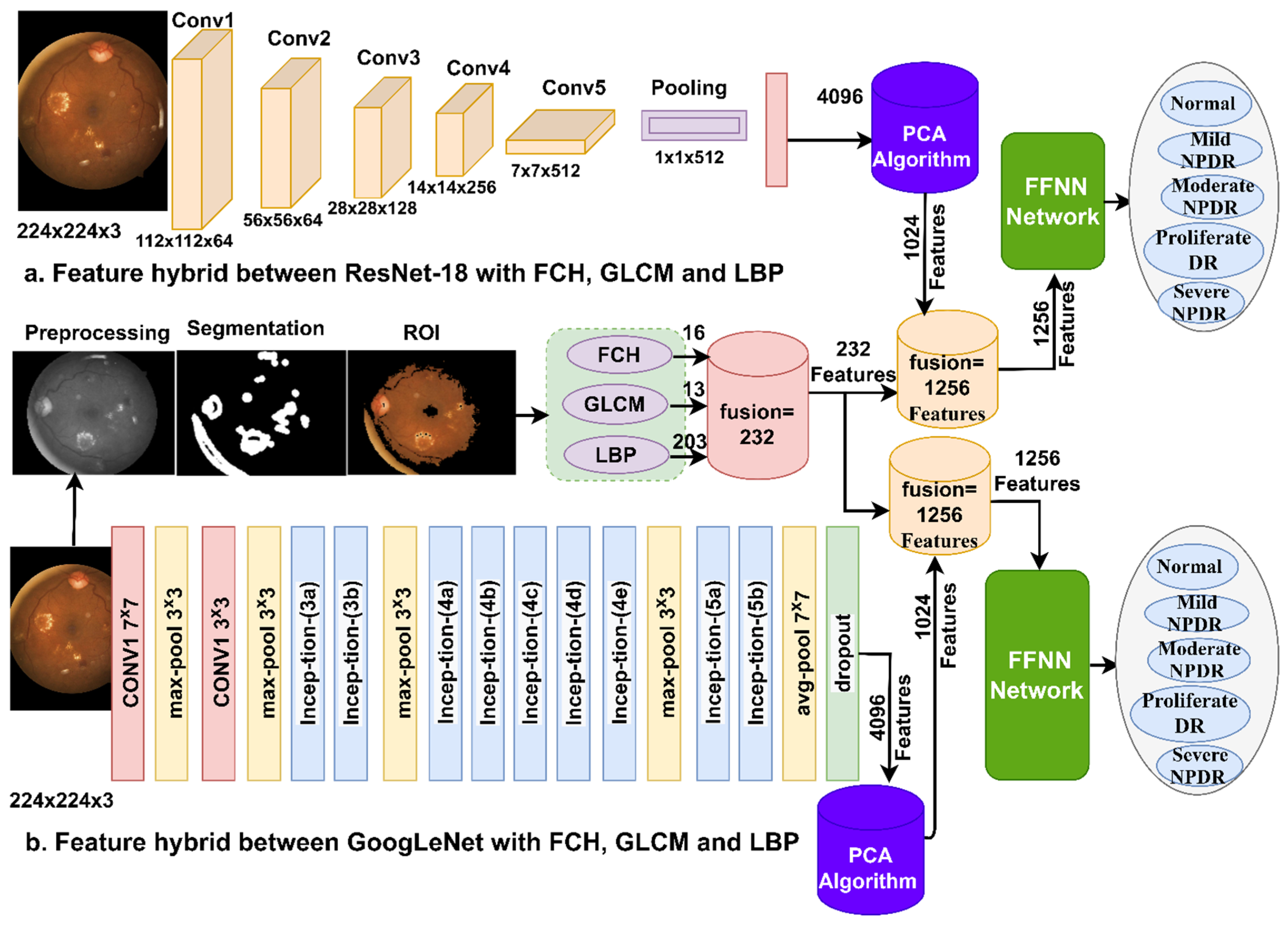 Diagnostics | Free Full-Text | Hybrid Methods for Fundus Image Analysis for Diagnosis of ...