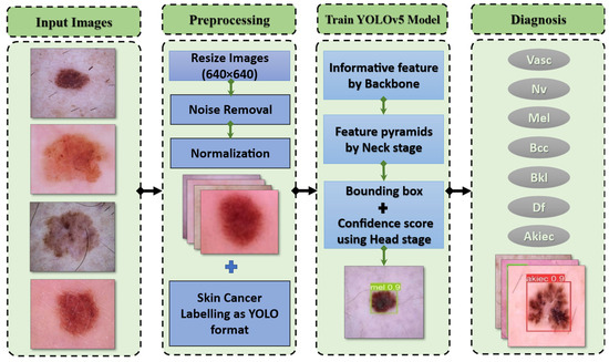 Diagnostics | Free Full-Text | Early Melanoma Detection Based on a ...