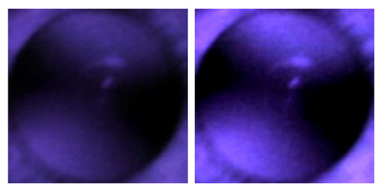 Automatic Refractive Error Estimation Using Deep Learning-Based Analysis of Red Reflex Images