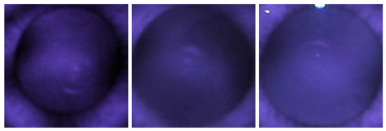 Automatic Refractive Error Estimation Using Deep Learning-Based Analysis of Red Reflex Images