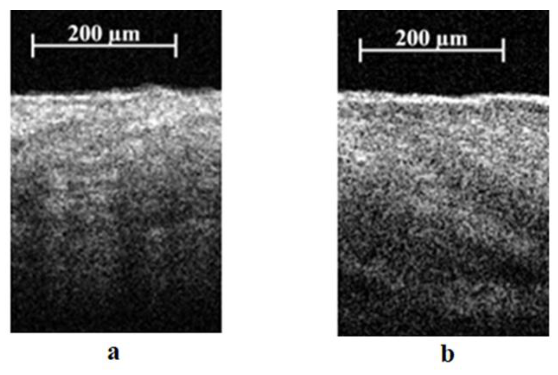 An Evaluation of Lymphedema Using Optical Coherence Tomography: A Rat ...