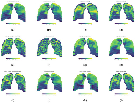 Quantitative Chest X-ray Radiomics for Therapy Response Monitoring in ...