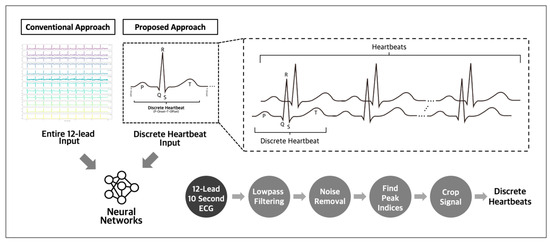 Diagnostics | Free Full-Text | Predicting Future Incidences of Cardiac Arrhythmias Using ...