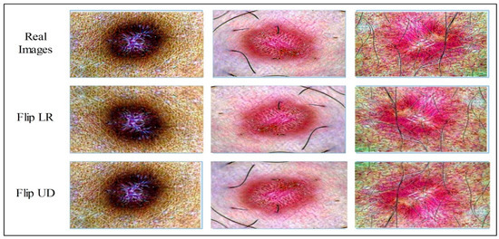 SkinNet-INIO: Multiclass Skin Lesion Localization and Classification ...
