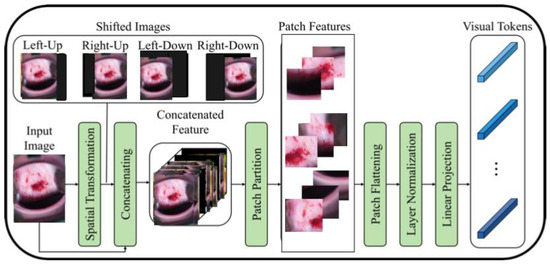 Diagnostics | Free Full-Text | Enhancing Cervical Pre-Cancerous Classification Using Advanced ...
