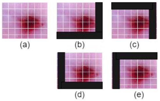Diagnostics | Free Full-Text | Enhancing Cervical Pre-Cancerous Classification Using Advanced ...